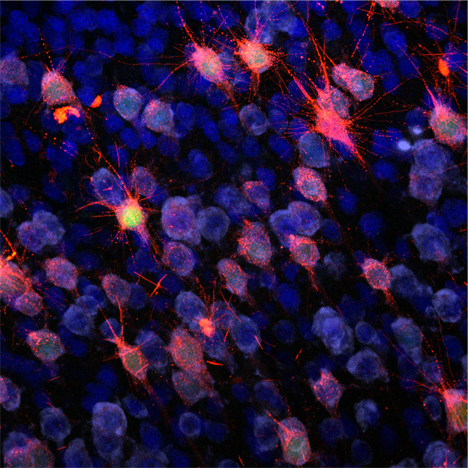 Research – Epilepsy Research